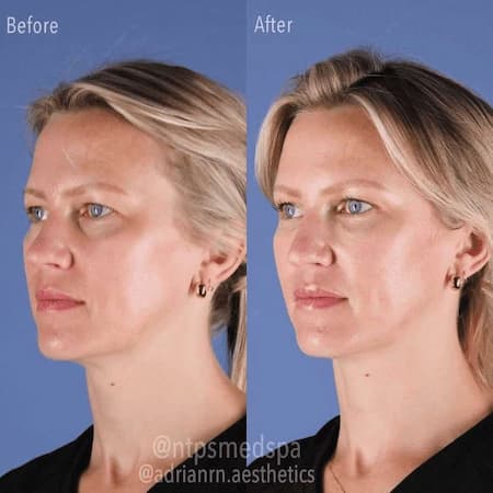 North Texas Plastic Surgery | Dallas Surgeon | Plano Cosmetic Surgery