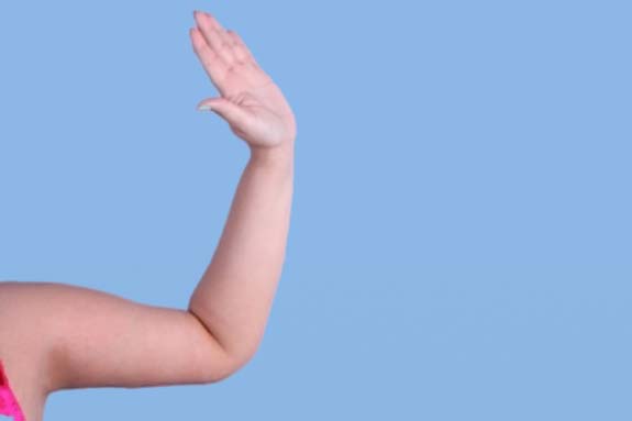 Arm Lift Before and After Photos